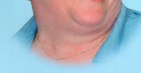 Madame Chantal Caron